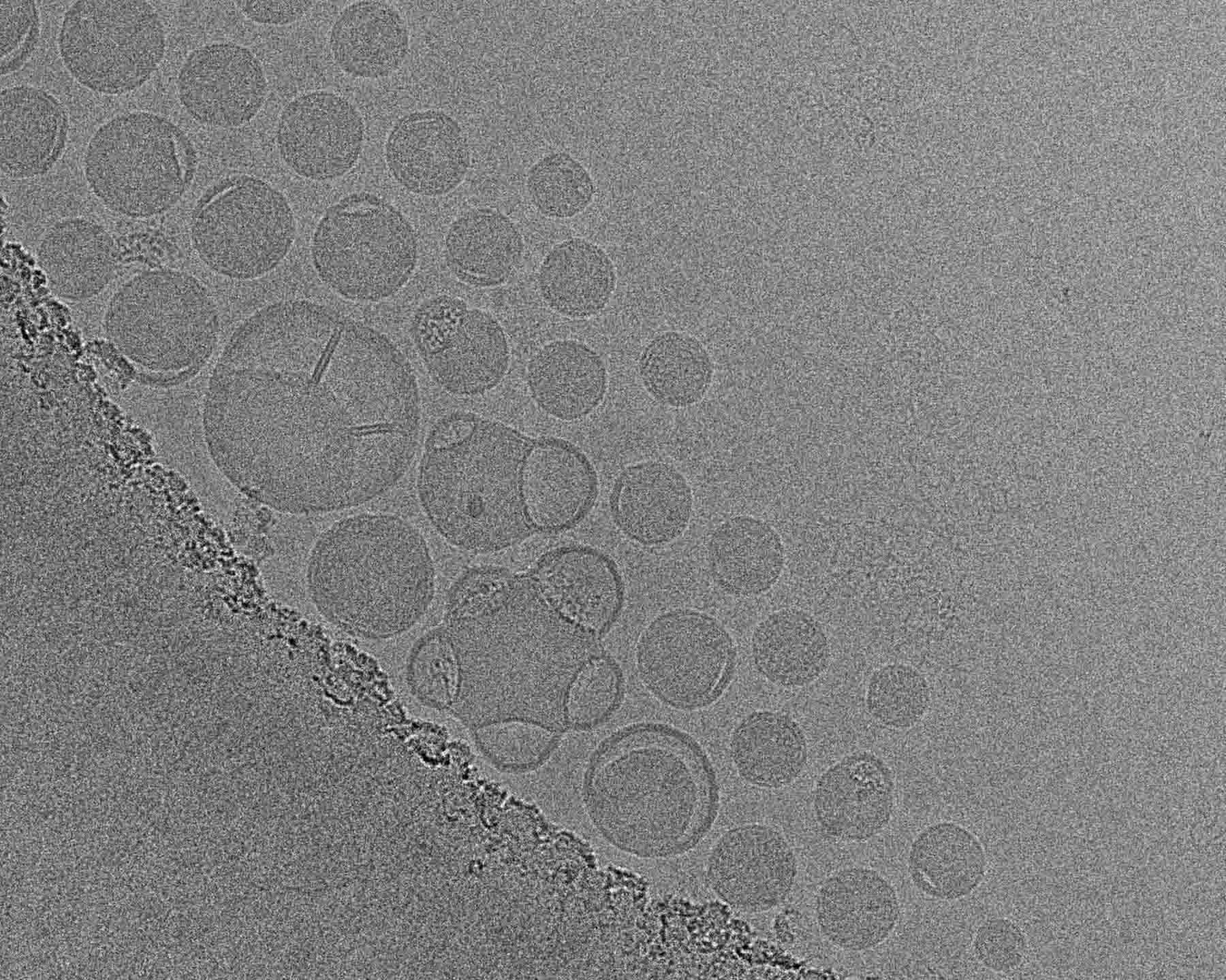 Lipid Nanoparticle characterization with cryo-TEM | Nano Imaging